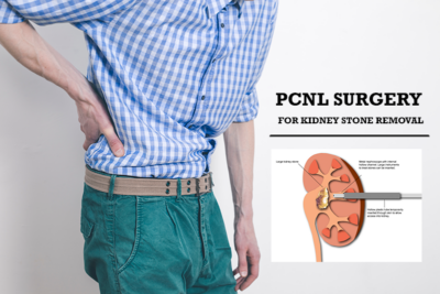 What Is Nephrolithotomy for Kidney Stones Removal? | Dr. Irfan Shaikh