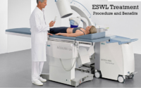 Procedure and Benefits of ESWL | Dr. Irfan Shaikh | Urolife Clinic, Pune