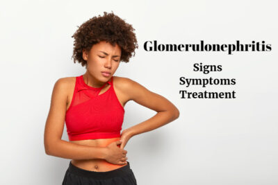 Glomerulonephritis - Signs, Symptoms and Treatment | Dr.Irfan Shaikh ...