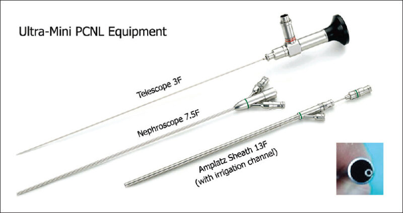 Best Urologist in Pune | Urolife Clinic in Pune | Dr. Irfan Shaikh