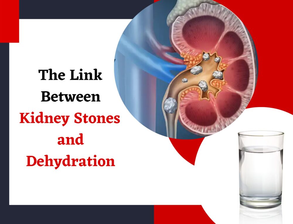 Symptoms and Signs of Kidney (Renal) Failure | Dr. Irfan Shaikh ...